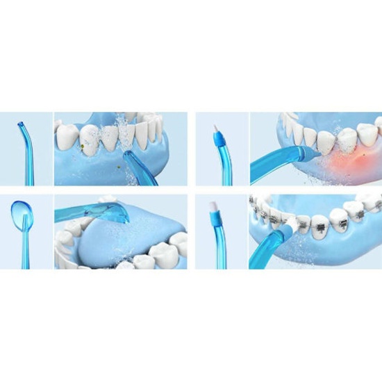 Ирригатор SOOCAS W3 Pro — купить в интернет-магазине ОНЛАЙН ТРЕЙД.РУ